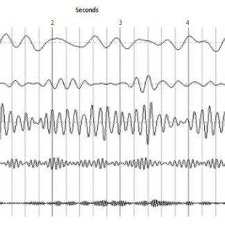 6 EEG Frequency Bands Bedard Et Al 2010 Download Scientific Diagram