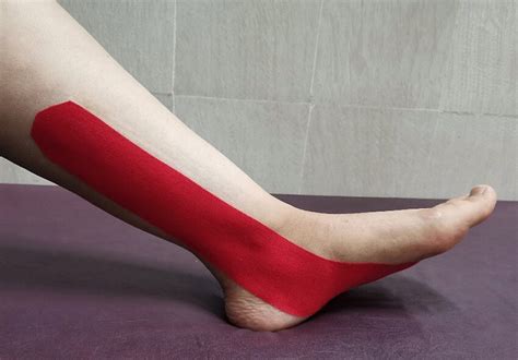 Tibialis Posterior Kinesio Taping Download Scientific Diagram