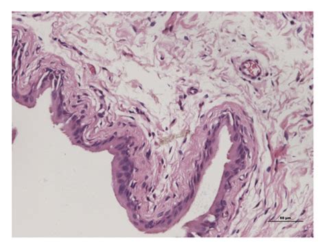 Observations Of The Bladder Biopsy Under A Microscope ×200 Cell