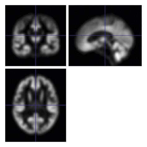 preprocessing results of a smri data and b fmri data download
