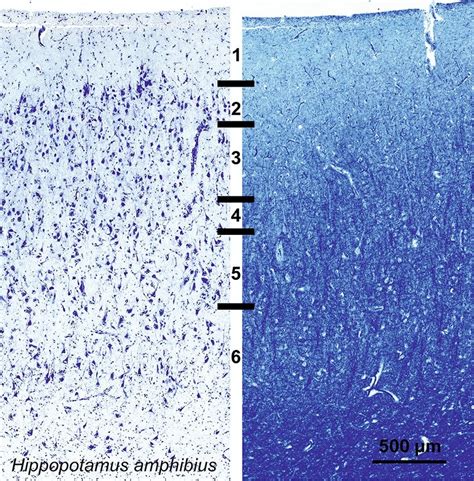 Photomicrograph Of Nissl Left And Kluver Barrera Right Stain Of The