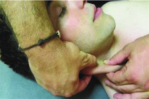 Manual Therapy Addressing Trigger Points In The Sternocleidomastoid Download Scientific Diagram