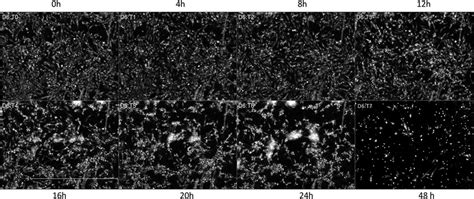Images Digital Phase Contrast Dpc For The Time Course Of Hcmec D3 Download Scientific