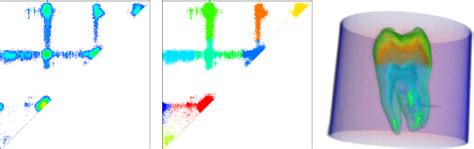 automatic tf design for rendering the tooth dataset a the lh