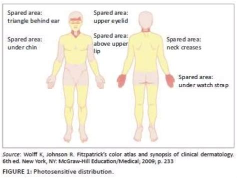 Approach To Photodermatoses Pptx