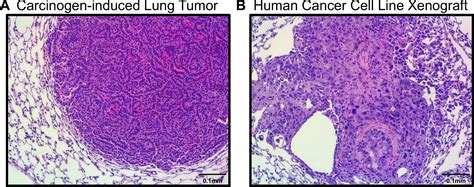 Video Perfusion And Inflation Of The Mouse Lung For Tumor Histology