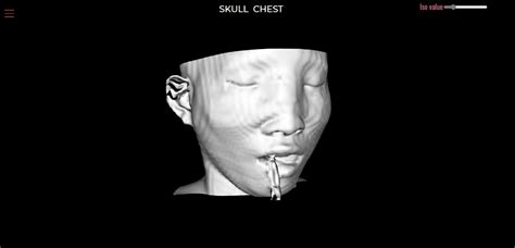 GitHub Abbas DICOM Image Viewer Used In D And D Analysis Volume Rendering Of DICOM