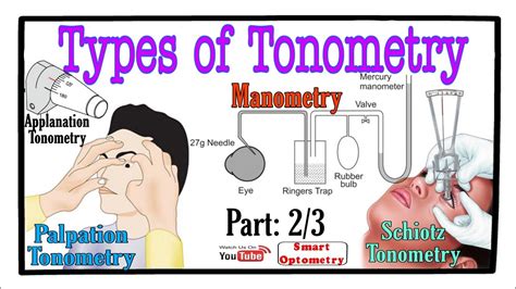 Tonometry All Types Of Tonometry 2 3 Youtube