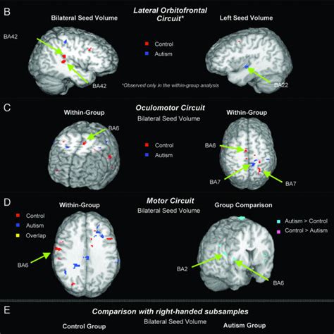 functional connectivity mri effects functional connectivity clusters