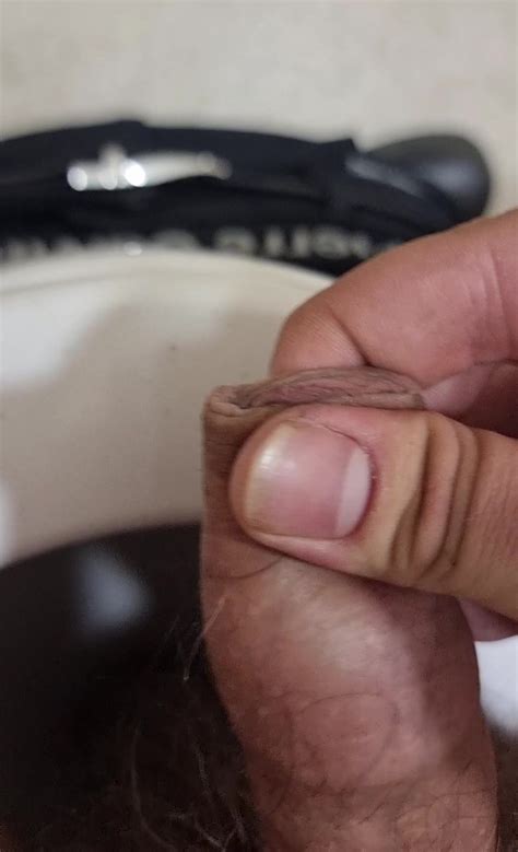 Cumming Inside My Foreskin Again