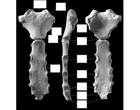 Sternum Labeling Quiz