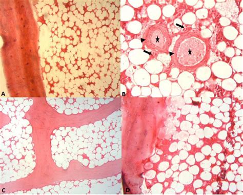 Photomicrography Of Tibial Bone Defects Of Rabbits With Induced Download Scientific Diagram