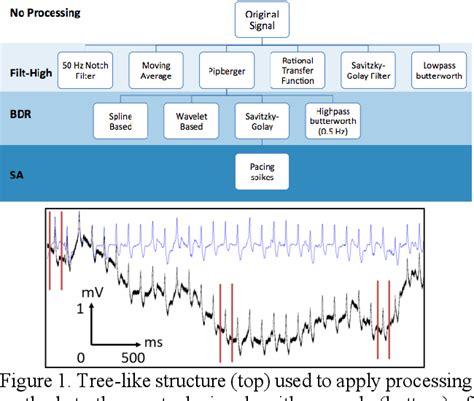 Figure 1 From Effects Of Ecg Signal Processing On The Inverse Problem