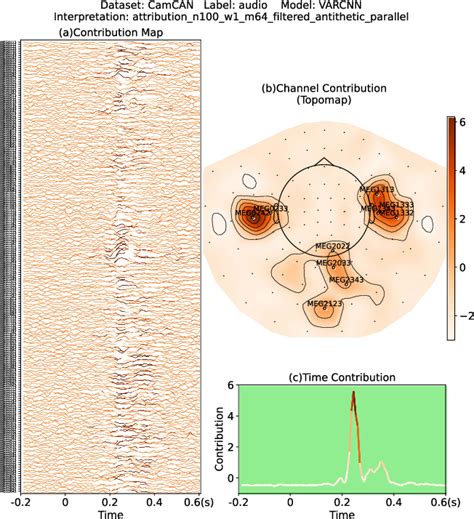 Figure 10 From A Model Agnostic Feature Attribution Approach To Magnetoencephalography