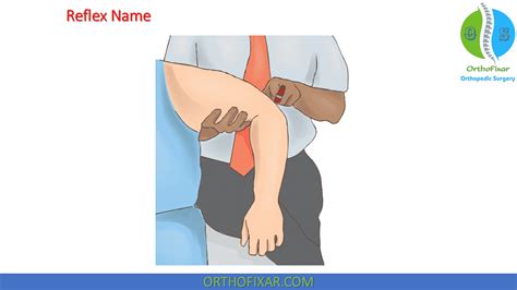 Deep Tendon Reflex Scale