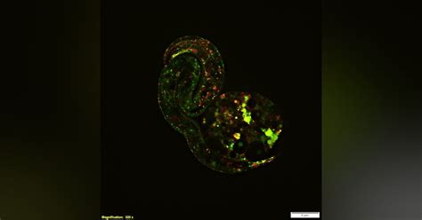 Advanced Imaging Optical Design Functional Superresolution Microscopy Progresses Laser Focus