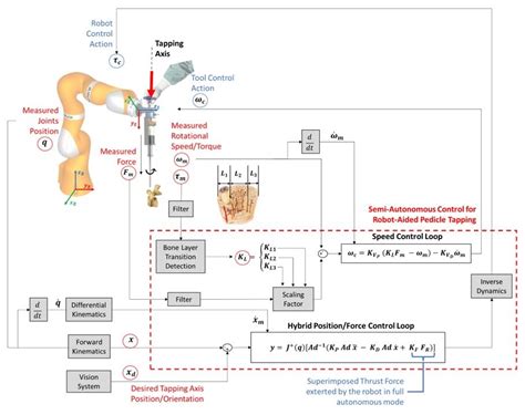 Automatic Robotic Platforms For Robot Aided Spinal Surgery Are Mostly Employed For Drilling The