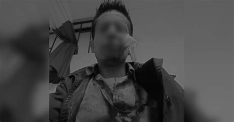 Conductor Del Sitp Fue Herido A Botellazos En Un Intento De Atraco En El Sur De Bogotá Infobae