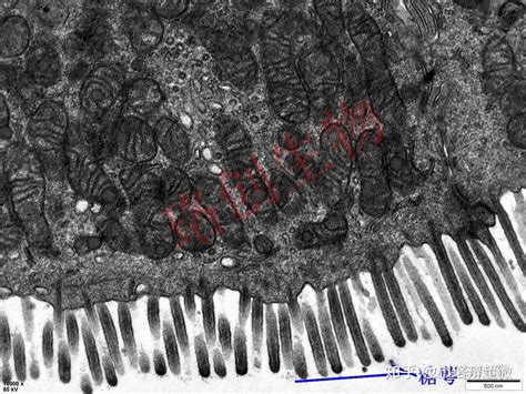 第二十六期：透射电镜下的肠上皮 知乎