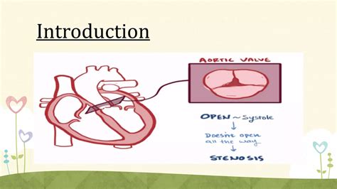 Aortic Stenosis Pptx