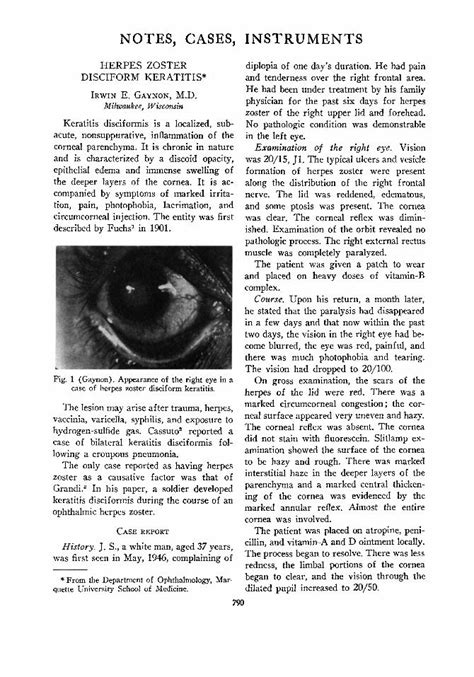 Pdf Herpes Zoster Disciform Keratitis Dokumentips