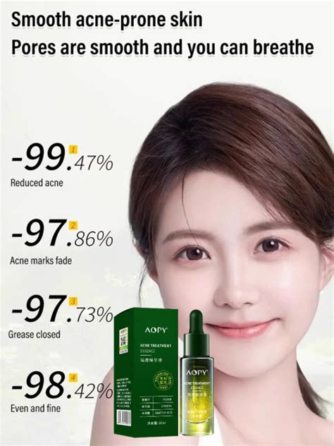 Original Essence Sensitive Skin Oil Fading Acne Marks Essence Lazada Ph