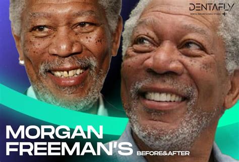 Celebrity Teeth Incredible Transformations Of 20 Stars