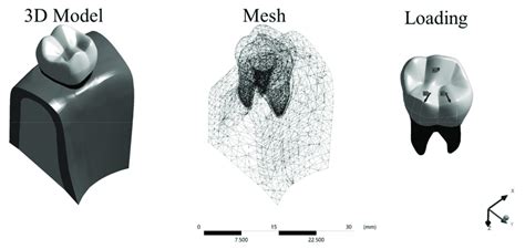 Finite Element Model Exported To The Analysis Software After The