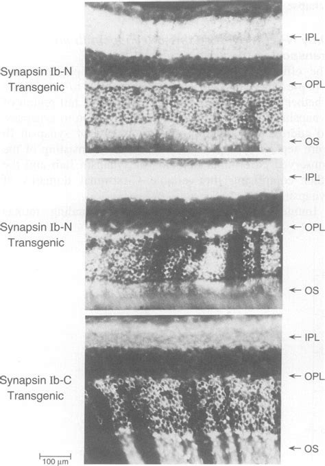 Only N Terminal But Not C Terminal Domains Of Synapsin Lb Are