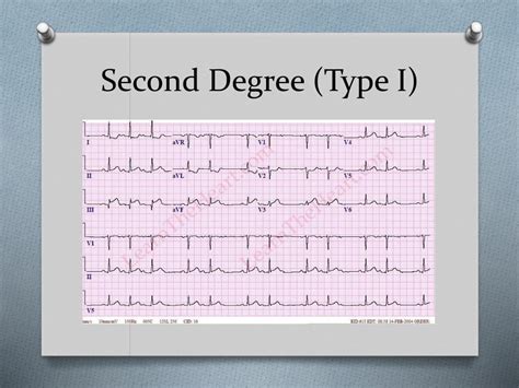Ppt Cardiology Ii Powerpoint Presentation Free Download Id 2244589