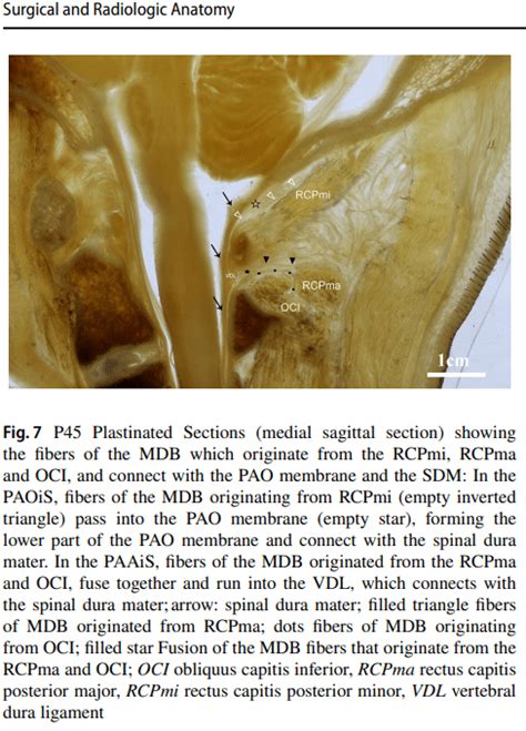Upper Cervical Anatomy And Cns Correlation Professionally Integrated Care