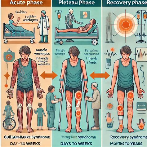 Guillain Barré Syndrome Gbs Causes Symptoms Diagnosis And Treatment