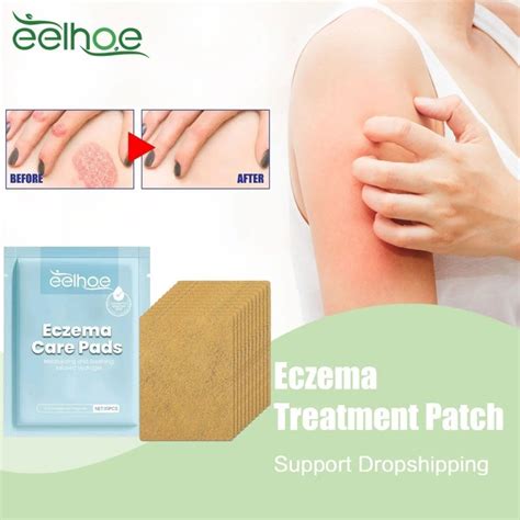 Eelhoe Eczema Treatment Patch Cure Psoriasis Hand Tinea Inhibit