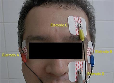 Figura416 Fixação Eletrodos Para Testes De Eletro Oculograma