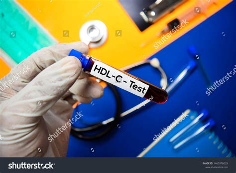 Hdl Test Photos And Images Shutterstock