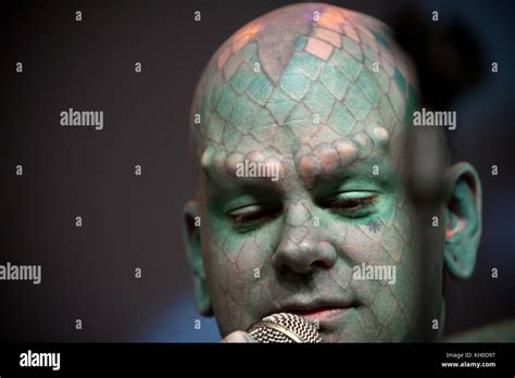 Body Modification Implants Spine