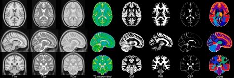 Magnetism Questions And Answers In Mri