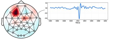 Example Of Signals Recorded Over A Graph Structure Left Sensors Download Scientific