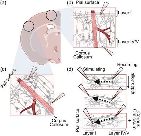 Placement Of Electrodes Depends On Direction Of Dendritic Projections Download Scientific
