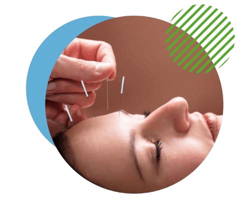 Outsource Acupuncture Billing Services Advancercm