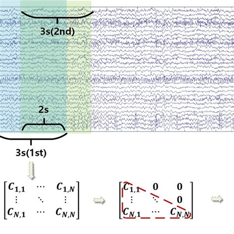 The Scheme Of Eeg Segmentation A For Time Series Of Each Trial A 3 Download Scientific