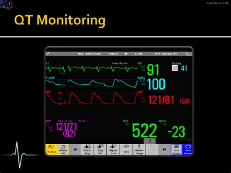 ppt beyond arrhythmias st and qt segment monitoring powerpoint