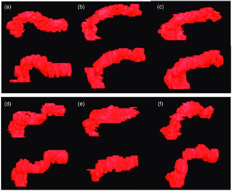 3d Segmentation Results By Automatic Segmentation And Manual Ground