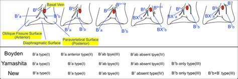 Thoracoscopic B7ab Type Medial Basal Segment Segmentectomy Jtcvs Techniques