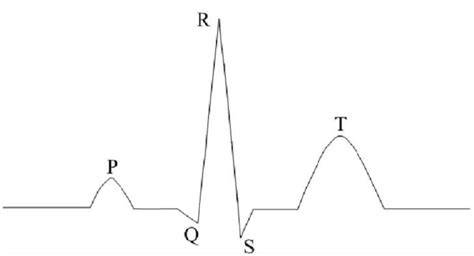 A Standard ECG Waveform Source Google Image Download Scientific Diagram