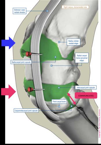 Lasx Arthrocentesis Flashcards Quizlet