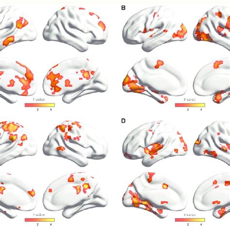 Functional Connectivity Of The Posterior Cingulate Cortex And An Download Scientific Diagram