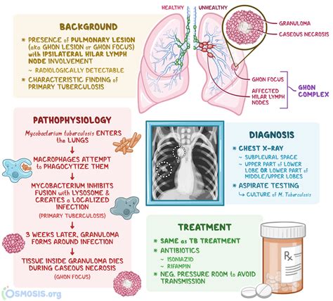Tuberculosis Lungs Diagram