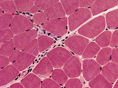 Skeletal Muscle Tissue Cross Section Muscle Tissue Basicmedical Key