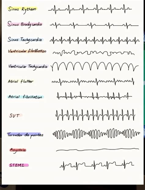 Heart Rhythm In 2025 Medical School Stuff Nursing School Motivation Nursing School Notes